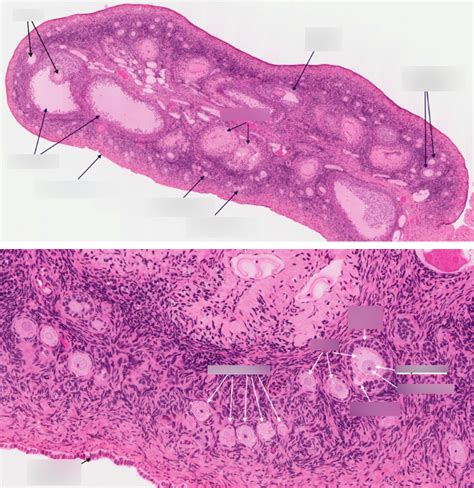 BMSC The Reproductive System The Ovary Diagram Quizlet