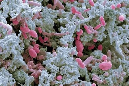 Microbiote Santé SVT MULLER