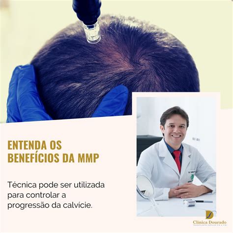 Entenda os benefícios da MMP Dr Daniel Dourado
