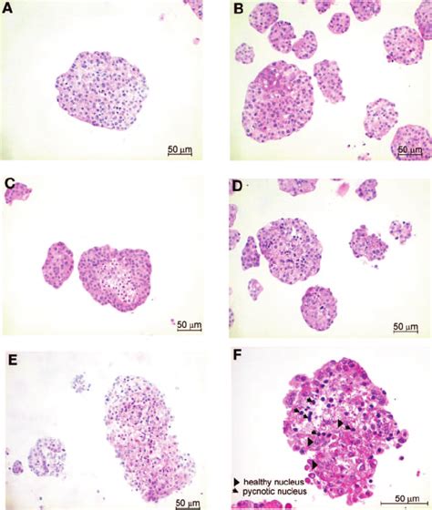 Islet Morphology At Normoxic Or Hypoxic Culture Conditions Isolated