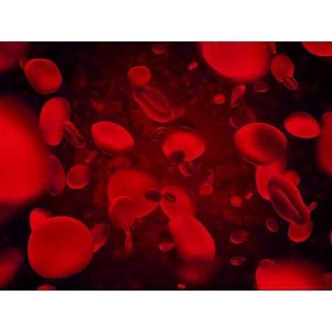 Pernicious Anemia Pathophysiology