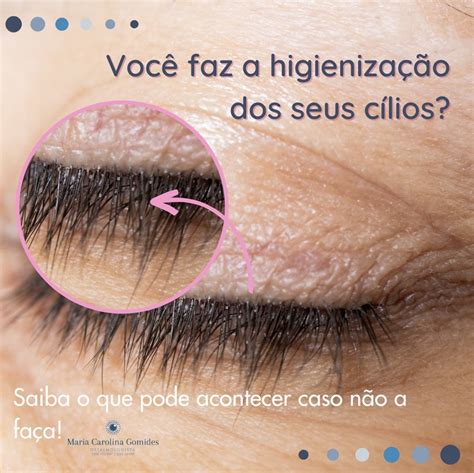 Higienização dos Cílios Dra Carolina Gomides Oftalmologista São