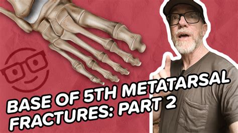 Hd Base Of Th Metatarsal Fractures Part Em Rap