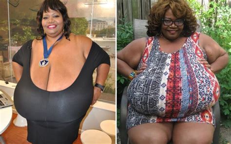 Annie Hawkins Turner La Femme Aux Plus Gros Seins Du Monde Gnadoe