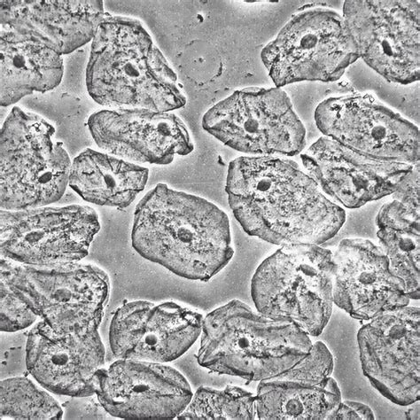 Cheek Cell Under Microscope