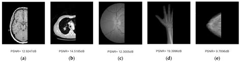 mathematics free full text robust zero watermarking algorithm for medical images using