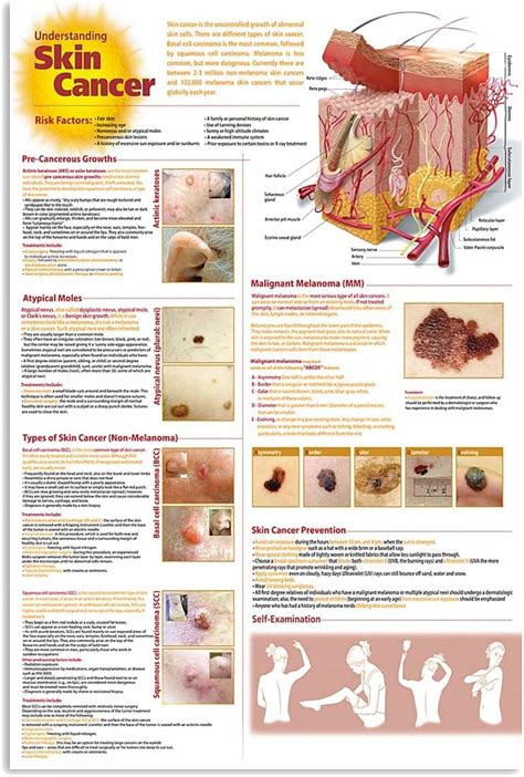 Amazon Kamito Dermatology Understanding Skin Cancer Poster Nna