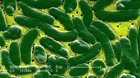 Qué es la bacteria come carne que asusta en Estados Unidos