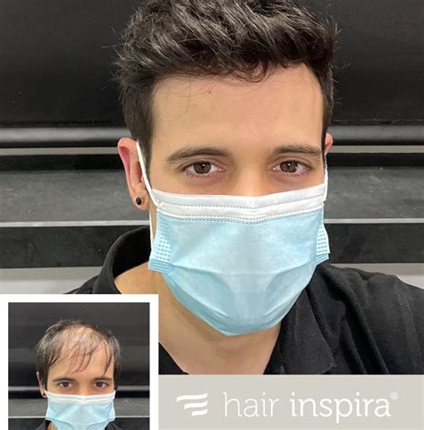 Prótesis capilar hombre el testimonio de Pablo Hair Inspira