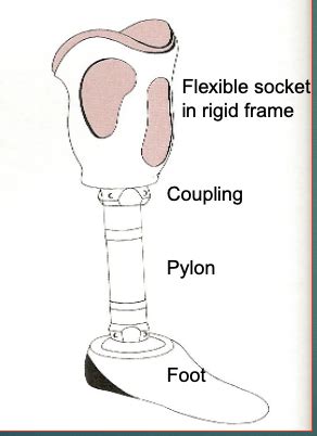 Transtibial Prosthetics Flashcards Quizlet