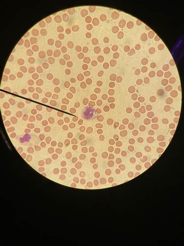 Wbc Morphology Flashcards Quizlet