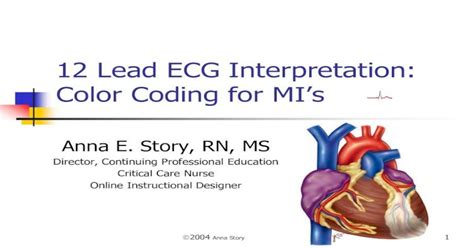 12 lead ecg interpretation color coding for mi ekg color codes pdf · pdf file the ecg tracing