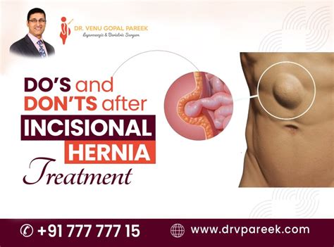 Dos And Donts After Incisional Hernia Treatment