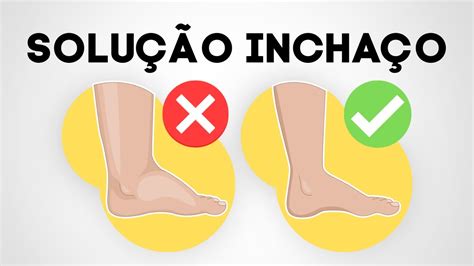 EXERCÍCIOS MÁGICOS PARA DESINCHAR AS PERNAS Perfeito pernas inchadas