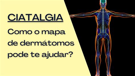 Ciatalgia ou dor ciática Veja como identificar a origem da dor YouTube
