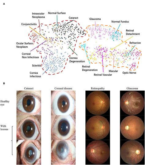 frontiers a novel hierarchical deep learning framework for diagnosing multiple visual