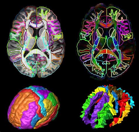 4 brain images mri brain brain science brain structure