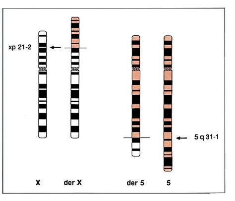 La myopathie de Duchenne du gène DMD à la dystrophine Semantic Scholar