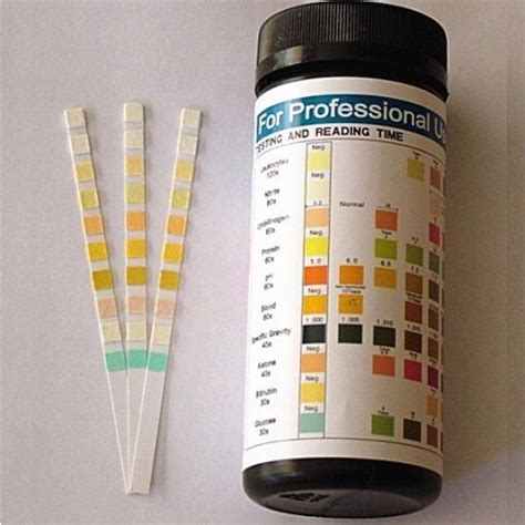 Module G3 Chemical Examination Of Urine Flashcards Quizlet