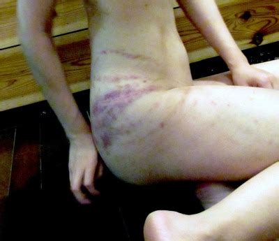 Women Bondage Bdsm Tumblr Tumbex