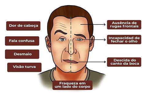 Avc O Que Tipos Sintomas Causas Tratamento E Sequelas Corpo