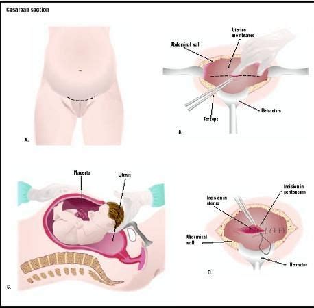 Sex Position To Lose Belly Fat