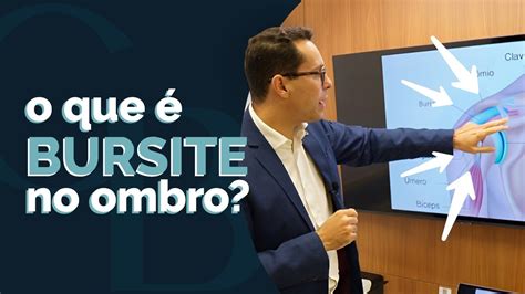 Bursite no Ombro Médico Ortopedista Dr Gustavo Barboza YouTube