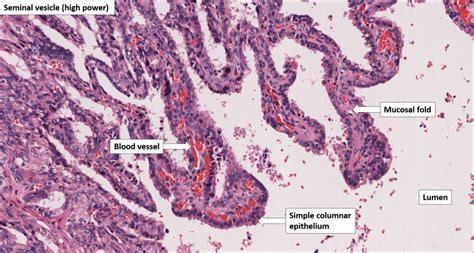 Seminal Vesicle Normal Histology NUS Pathweb NUS Pathweb