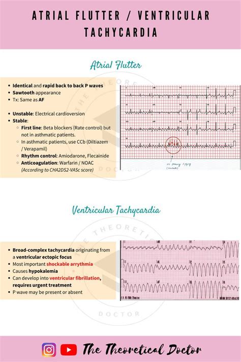 Pin On Cardiology Mbbs Flashdash