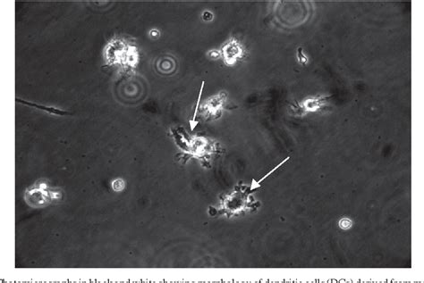 [pdf] observation of dendritic cell morphology under light phase contrast or confocal laser