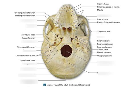 Inferior View Of The Adult Skull Diagram Quizlet