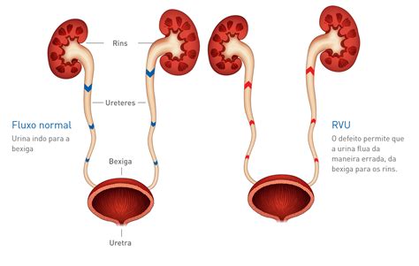 Anatomia Del Sistema Urinario Vejiga Urinaria Rinon Images The Best