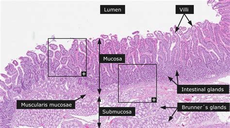 Histological Slides Of The Duodenum Google Search Histology Slides