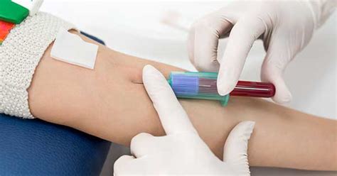 Por qué necesito una prueba de sodio en la sangre ClikiSalud net