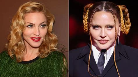 Madonna S Face Changing Tweaks Revealed As Surgeon Details Exactly What