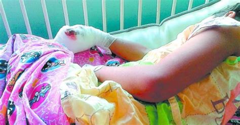 Siete quemados por pólvora se reportan en San Pedro y Tegucigalpa