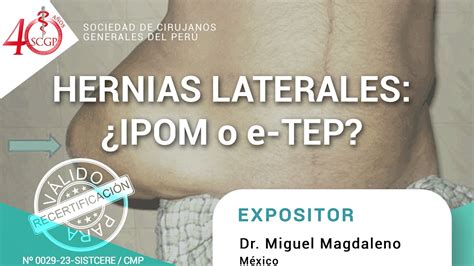 HERNIAS LATERALES IPOM O E TEP YouTube