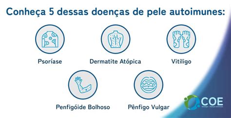 Doença de pele autoimune como identificar COE