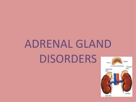 Adrenal Gland Disorders Ppt