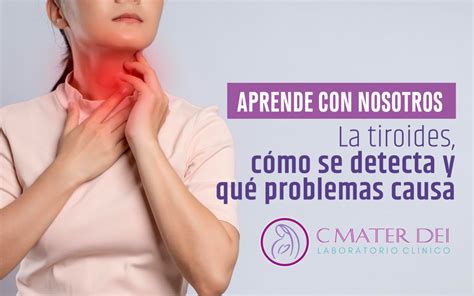 Introducir 85 Images Dolor En La Manzana De Adan Viaterra Mx
