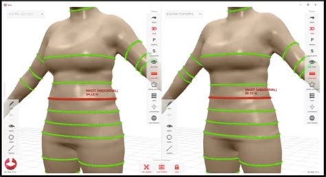 D Body Scanner Bv Medical Solution