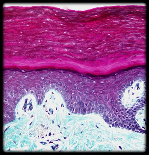 Thick Skin Histology Diagram Quizlet