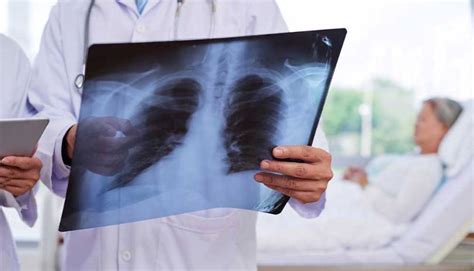 Fiebre tos y dificultad para respirar cuidado puede ser neumonía