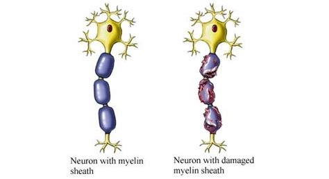Naked Neurons One Life Livin The Dream