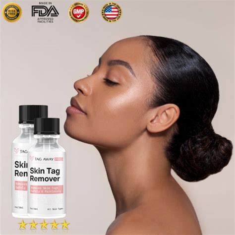 Audio Tag Away Pro Skin Tag Remover