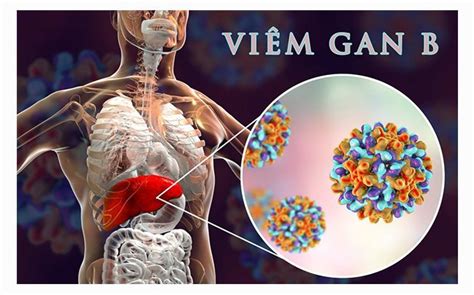 Vắc xin Heberbiovac 1ml phòng bệnh viêm gan B hiệu quả