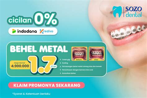 Harga Behel Gigi Jenis Dan Proses Pemasangan