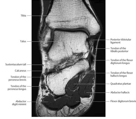 Ankle And Foot Radiology Key