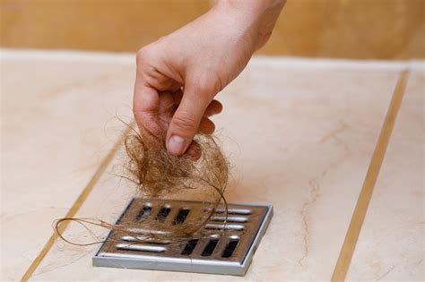 12 Alarming Signs Youre Losing Too Much Hair HairstyleCamp