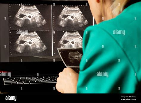 Échographie de l abdomen d une femme sur un écran d ordinateur portable